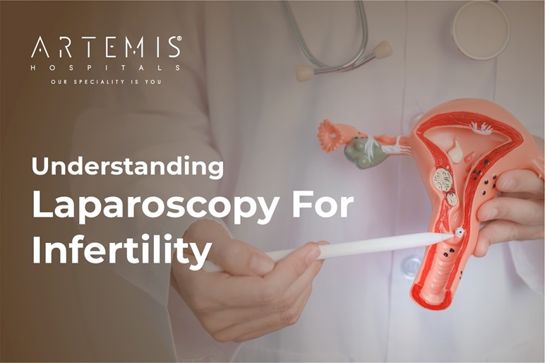 Laparoscopy for Infertility: What it is, Procedure, and Benefits ...